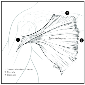 Injuries of the Pectoralis Major: Diagnosis and Management | Published ...