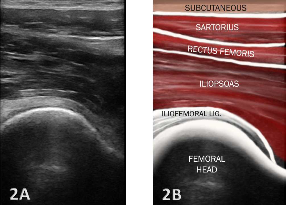 The Use of Diagnostic Musculoskeletal Ultrasound for the Evaluation of ...