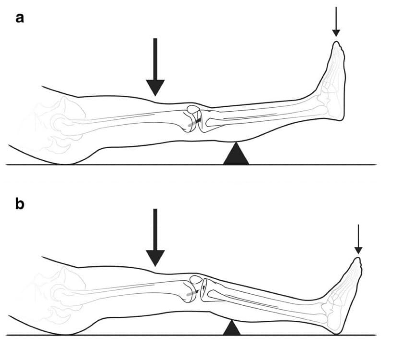 The Stabilized Lachman's Test: A Highly Sensitive, Specific and ...
