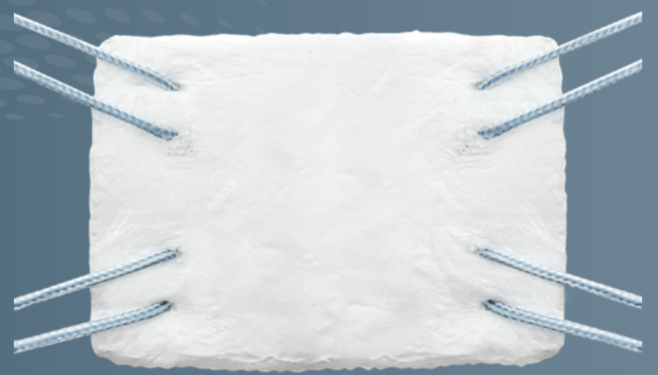 The Next Frontier for Rotator Cuff Augmentation? Strength + Bio ...