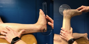 The Single Leg Squat Test: A “Top-Down” or “Bottom-Up” Functional ...