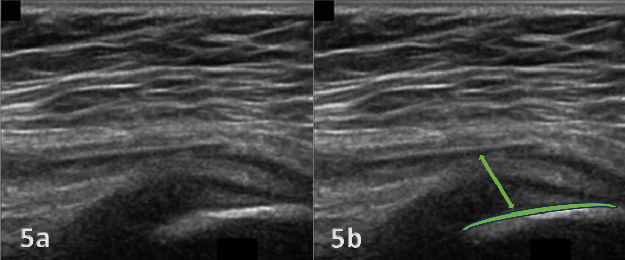 The Utilization of Diagnostic Musculoskeletal Ultrasound in the ...