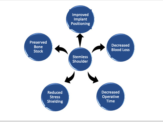 Stemless Humeral Implants in Anatomic Total Shoulder Arthroplasty: The ...