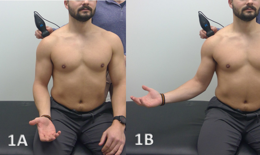 MSK Diagnostic Ultrasound for the Assessment of the Acromioclavicular ...