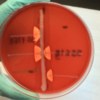 Group B Streptococcus (Streptococcus agalactiae) Isolation ...