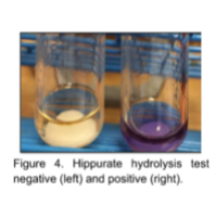 Hippurate hydrolisis test for group B Streptococcus identification.