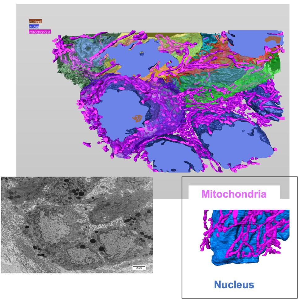 2D and 3D Electron Microscopy (EM) Imaging of Tissue Biopsies and ...