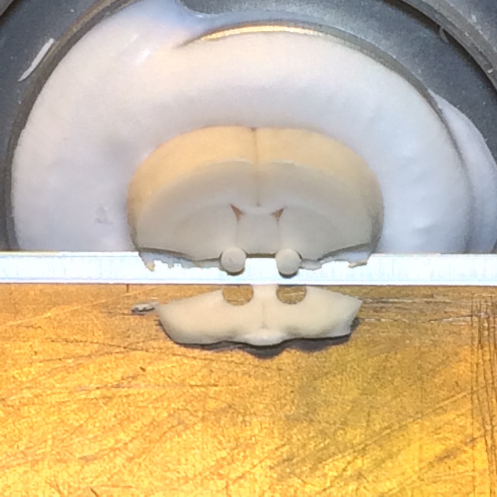 Fresh Frozen Mouse Brain Preparation (for Single Nuclei Sequencing)