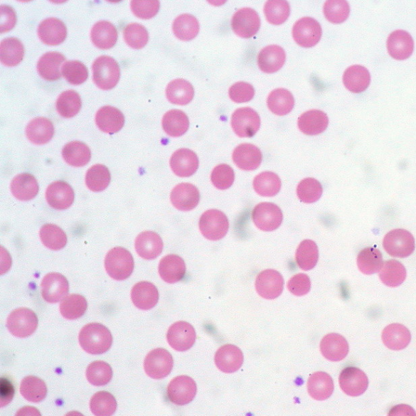 Eosin-5’-maleimide (EMA) binding test with fluorecent beads
