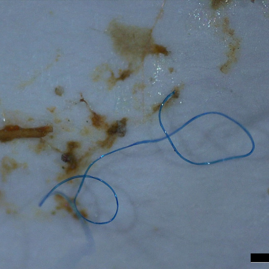 Seawater sample preparation for microplastic determination