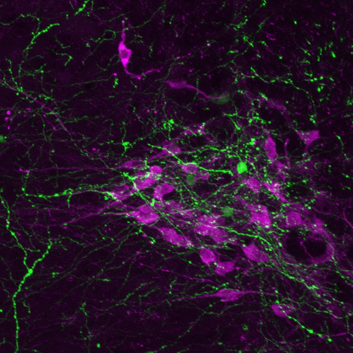 Immunohistochemical labelling of spinal cord neurons involved in ...
