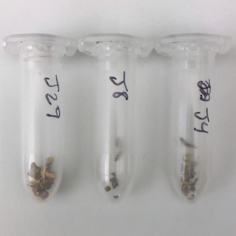 DNA Extraction from Modern Dental Calculus