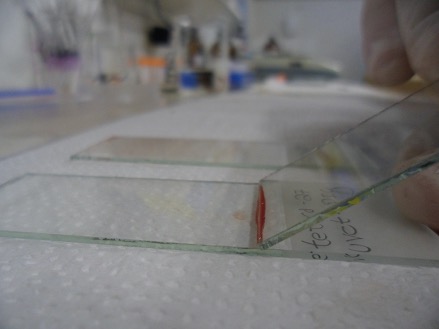 Staining of fish Red Blood Cells