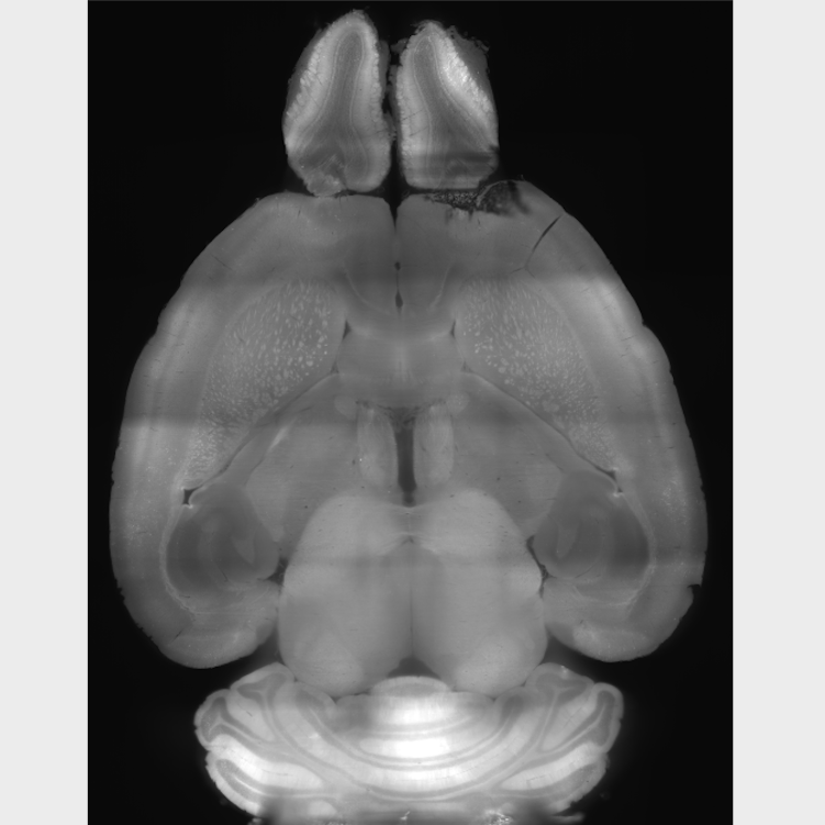 'Uniclear' water-based brain clearing for light sheet imaging of ...