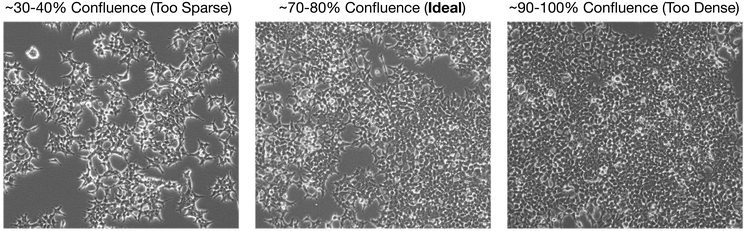 AAV Production in HEK293T Cells