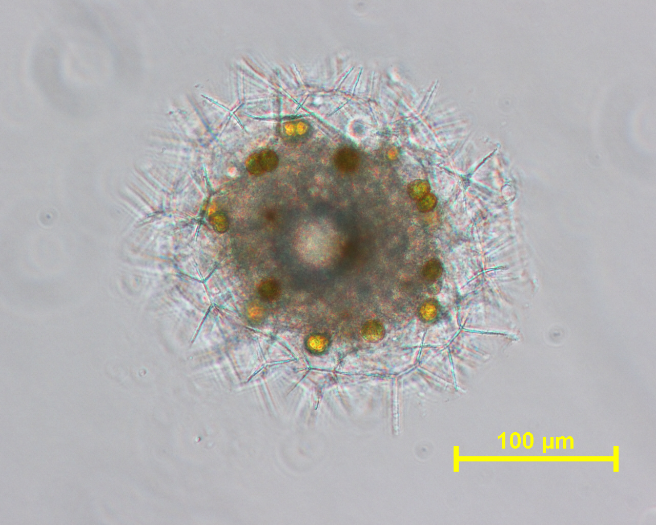 Collect of Collodarian (Rhizaria, Radiolaria) nuclei for genomic analyses