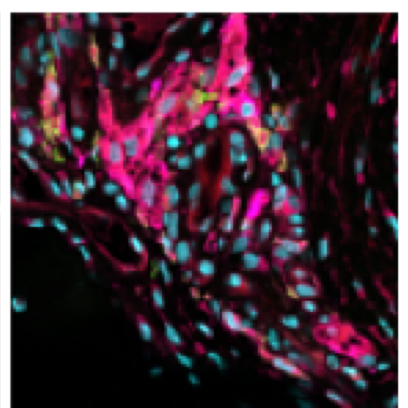 Single Nuclei RNA Sequencing of Tendon Tissue - small tissue biopsies