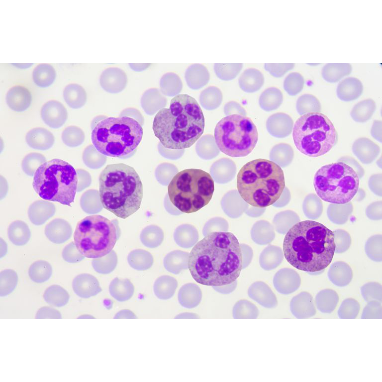 PMN- 01a - Isolation of Human PMN from Buffy Coat