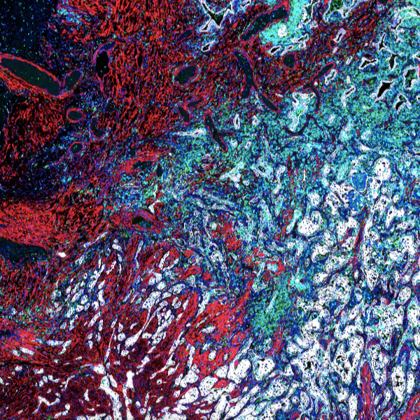 Tissue Cyclic Immunofluorescence (t-CyCIF)
