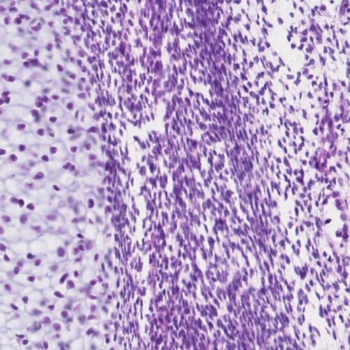 Embedding and freezing fresh human tissue in OCT using isopentane