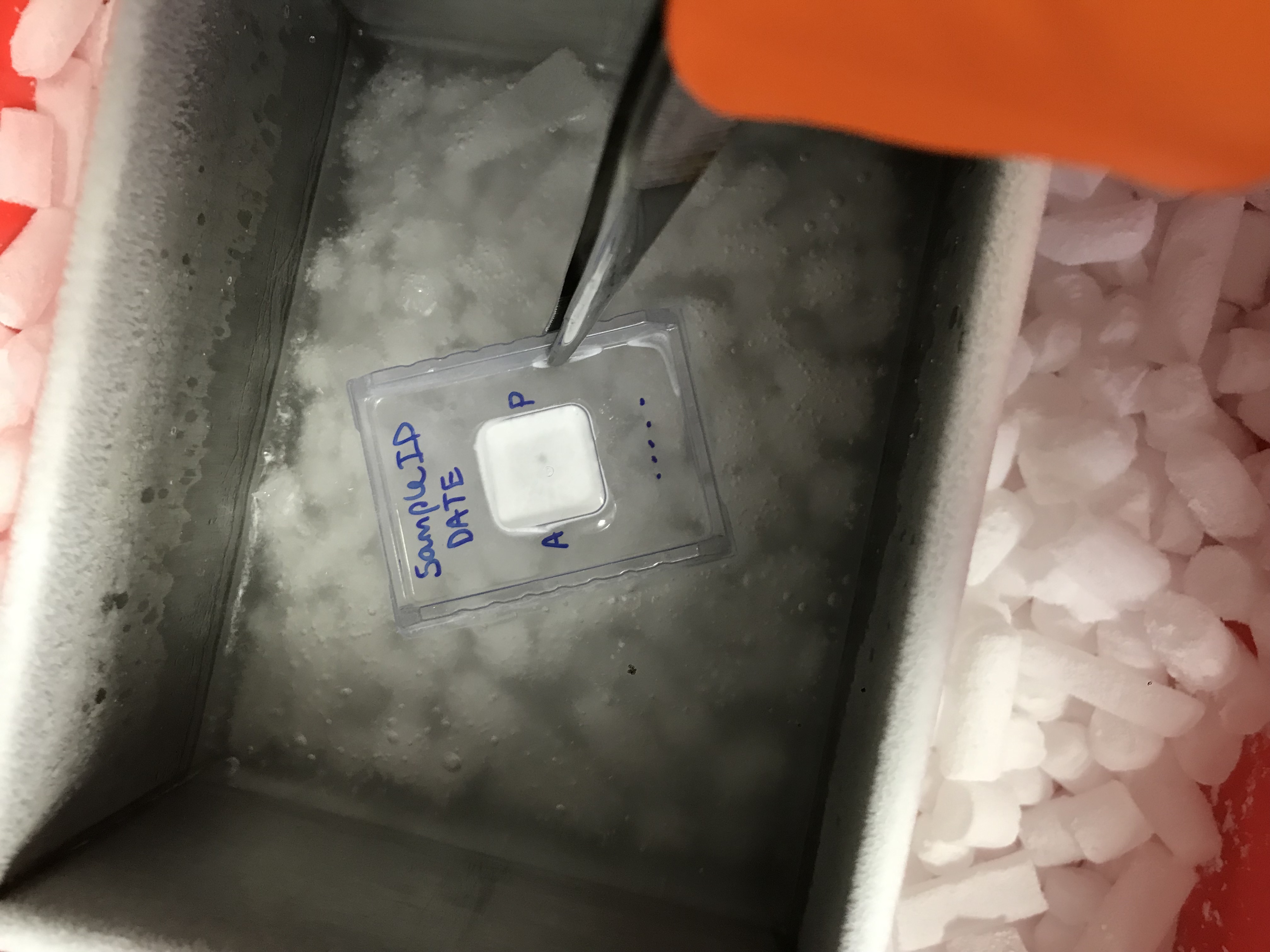 Embedding and freezing fresh human tissue in OCT using isopentane