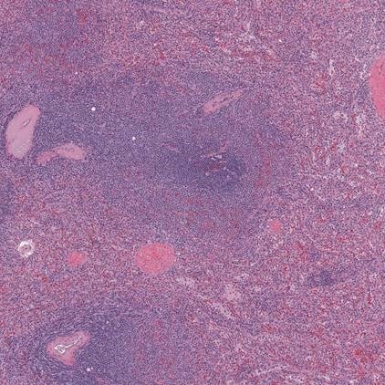 FFPE Tissue Sectioning for Staining