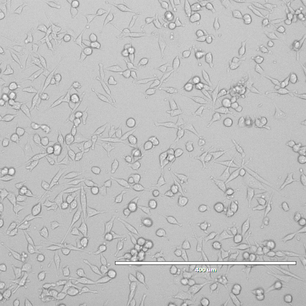 MC38 and B16-F10 culture media