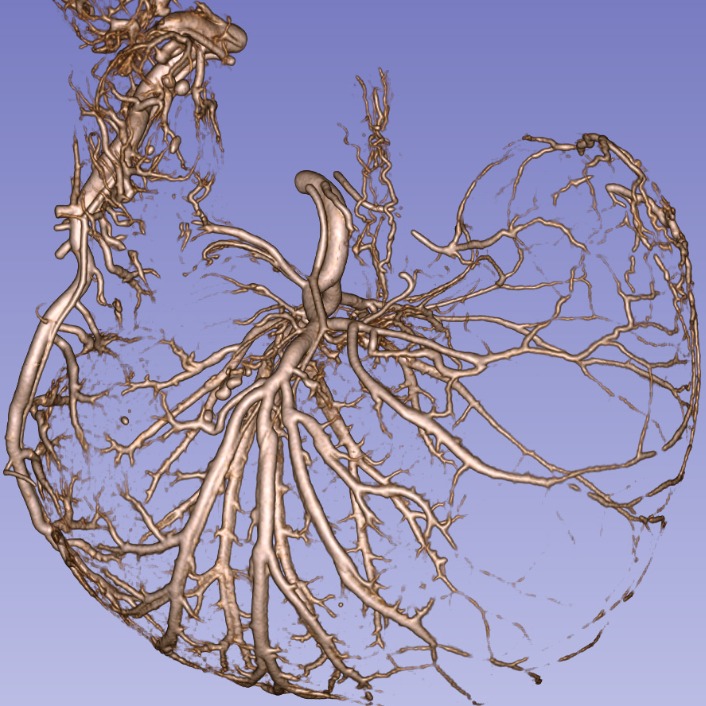 Micro-CT imaging of rat stomach vasculature