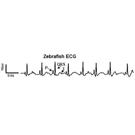 Adult zebrafish ECG recording using the iWorx ECG system