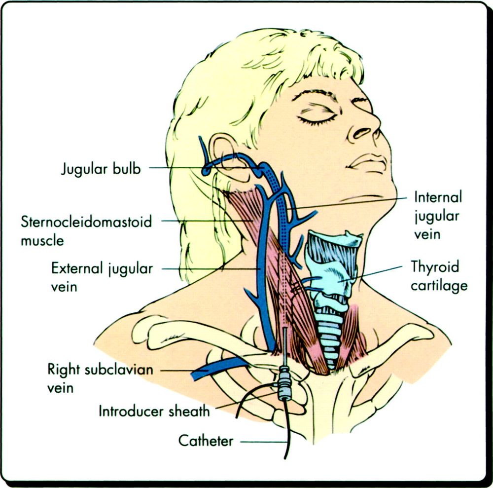 To help improve the quality of the lyrics, visit “The Crazies” by Mr ...