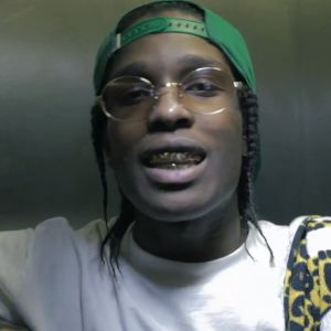 Asap Rocky Teeth Before