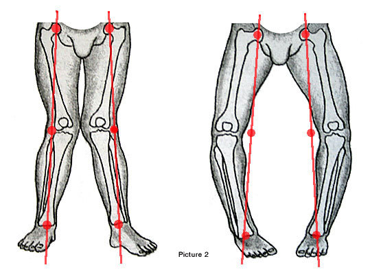 Cause When it comes to being BOWLEG, you know.. – Jus Daze vs HFK