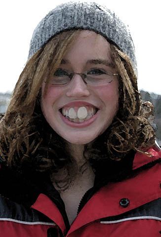 How come some people always have their teeth sticking out? | IGN Boards