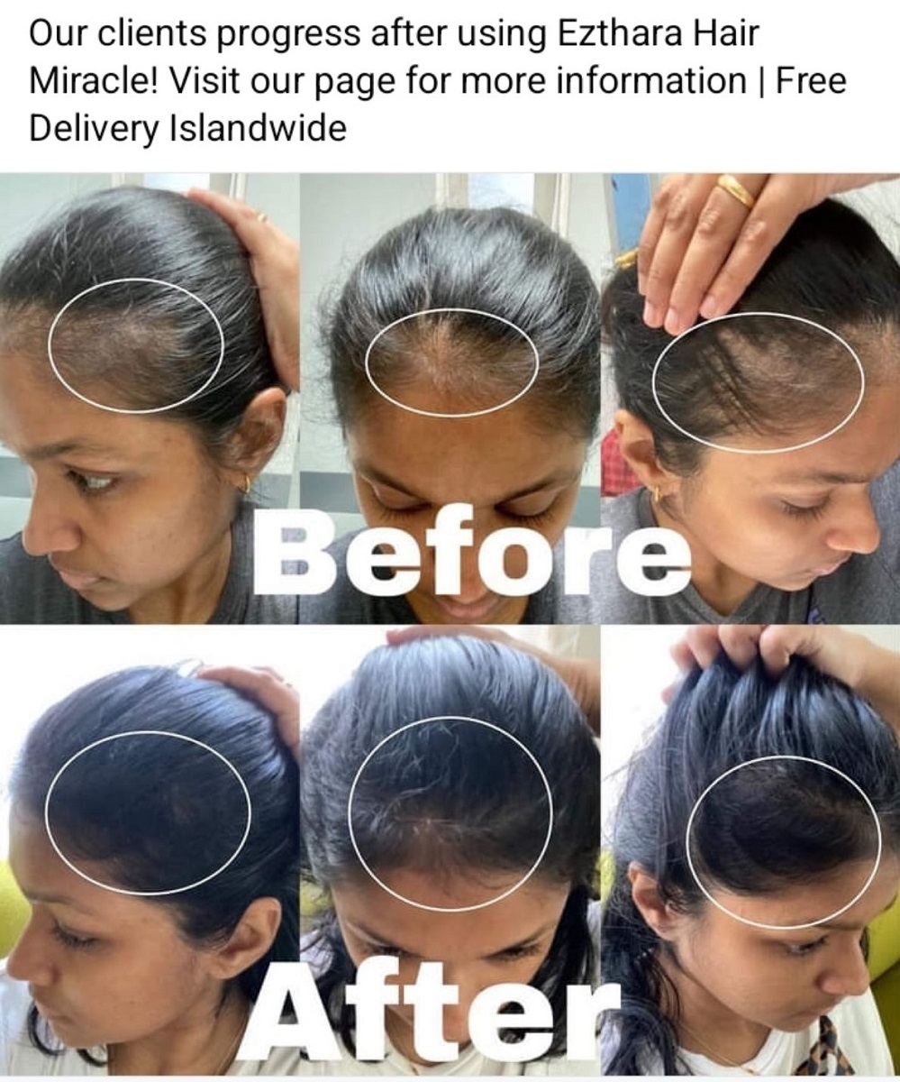 eTukuri - Products | EZTHARA Hair Miracle, An effective Hair Cream