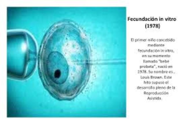 A 100 Years of EAM. What has happened in those years? timeline | Timet