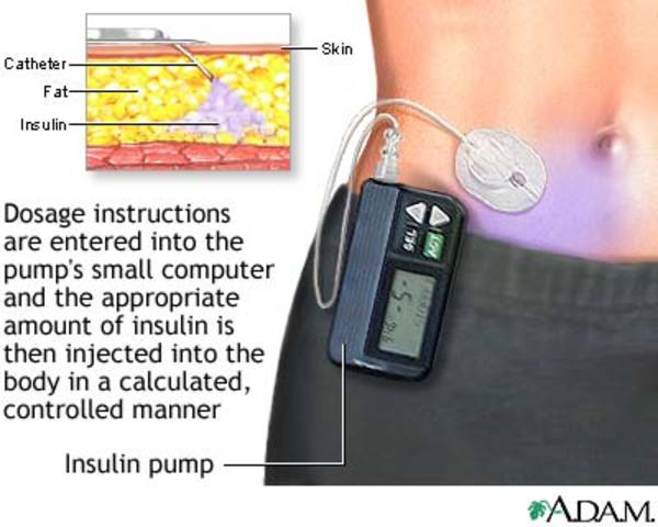 Evolution of Insulin timeline | Timetoast timelines