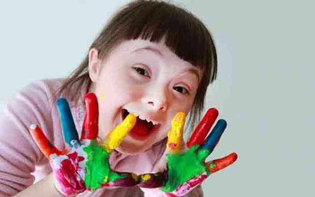 Evolución conceptual de retraso mental a discapacidad cognitiva