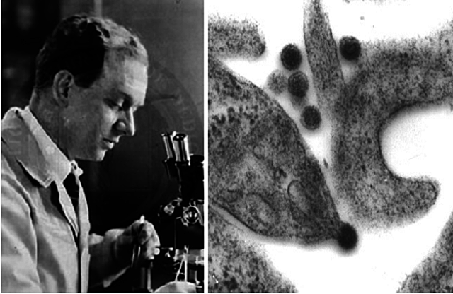 Historia de la microbiologia timeline | Timetoast timelines