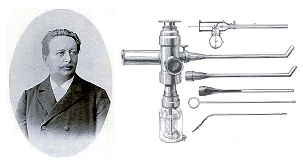 HISTORIA DE LA LAPAROSCOPIA timeline | Timetoast timelines