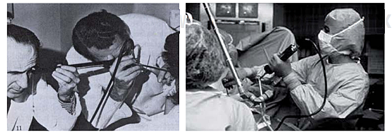 HISTORIA DE LA LAPAROSCOPIA timeline | Timetoast timelines