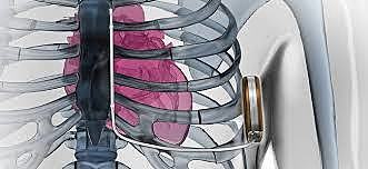 Antescedentes historicos de UCI timeline | Timetoast timelines