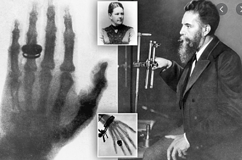 Landmarks in Radiation therapy timeline | Timetoast timelines