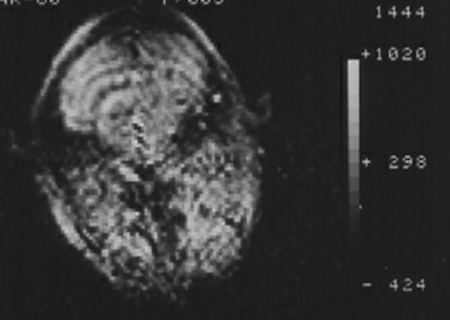 RAYOS X timeline | Timetoast timelines