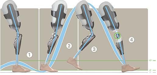 Historique de la prothèse de jambe timeline | Timetoast timelines
