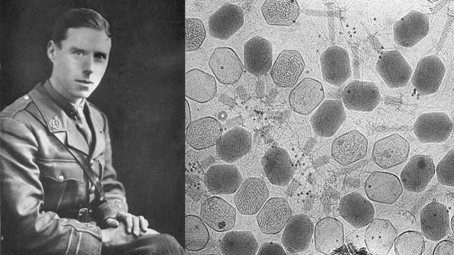 Historia de la Microbiología Aplicada. Adriana Deeann Higuera.