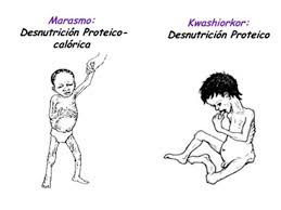 Inanición timeline | Timetoast timelines