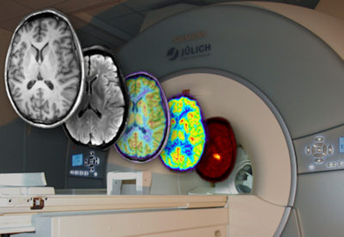 The History Of MRI Scans timeline | Timetoast timelines