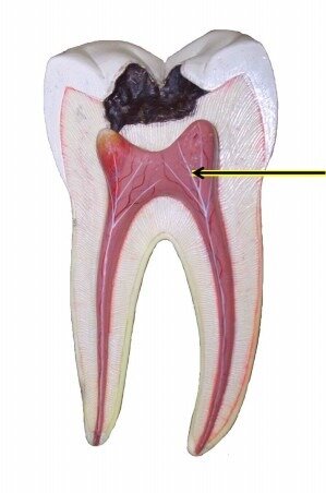 Antecedentes históricos de la endodoncia. timeline | Timetoast