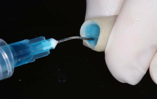 Odontología restauradora timeline | Timetoast timelines