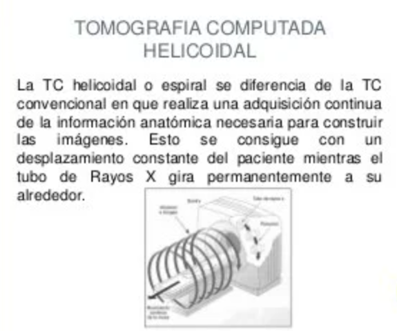 Historia del TC por EDWIN FABIAN BLANCO BERNAL...UNAD timeline | Timet